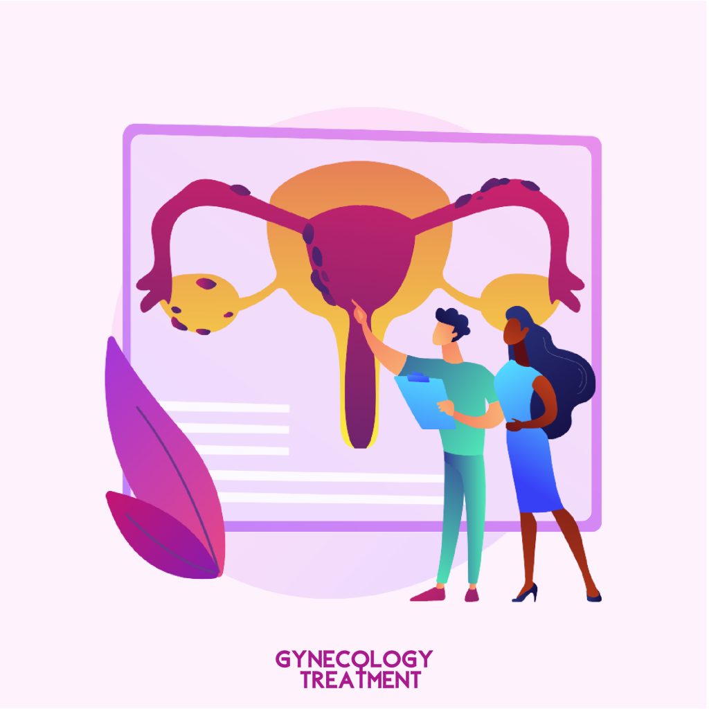 Polycystic Ovary Syndrome – Gynecology Treatment